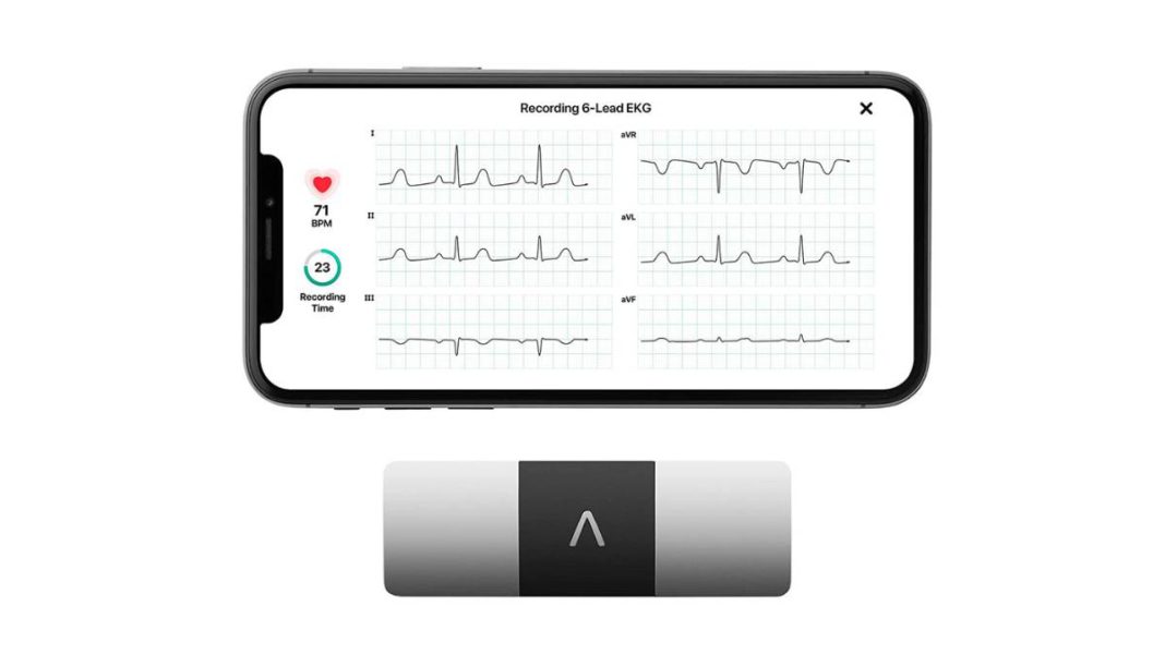 A New FDA-Approved AI and Bluetooth-enabled ECG Device
